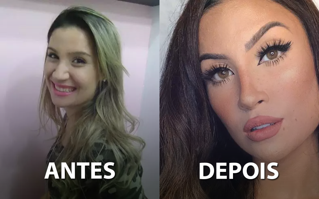 Boca Rosa antes e depois – Descubra quais procedimentos ela realizou ...